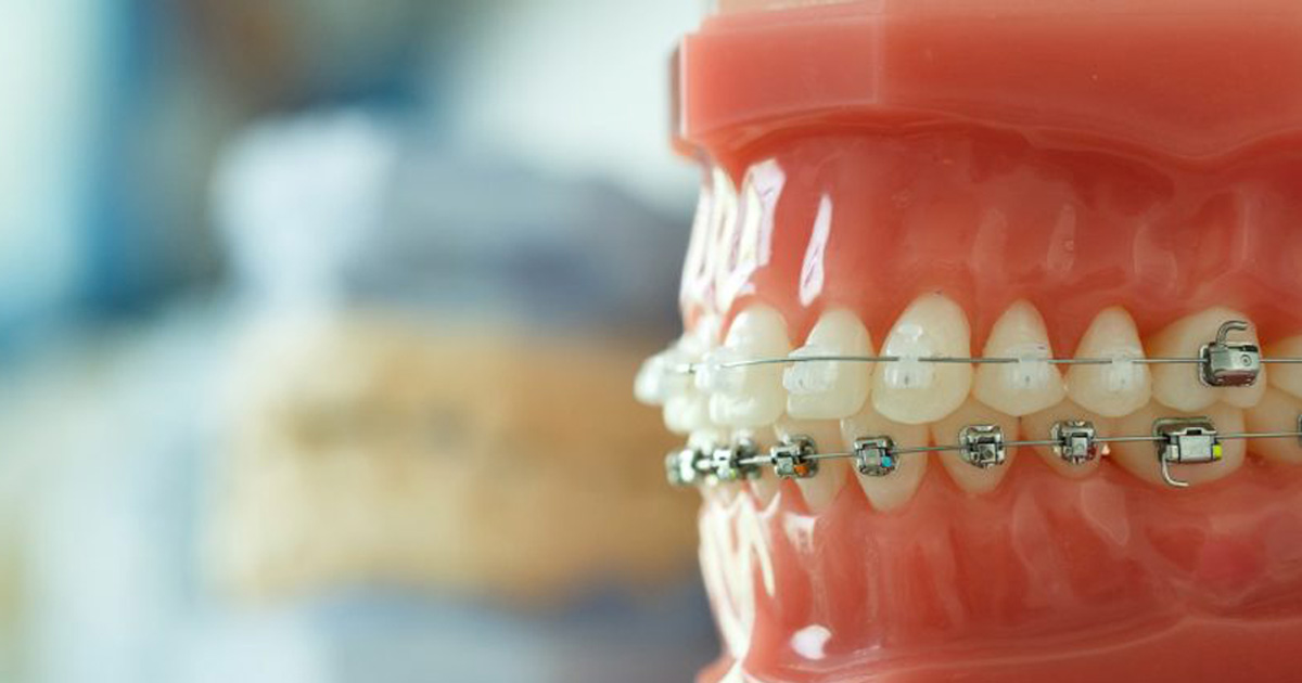 Leading Orthodontics in Long Beach CA | FUNtastic Dental Leading Orthodontics in Long Beach CA | FUNtastic Dental